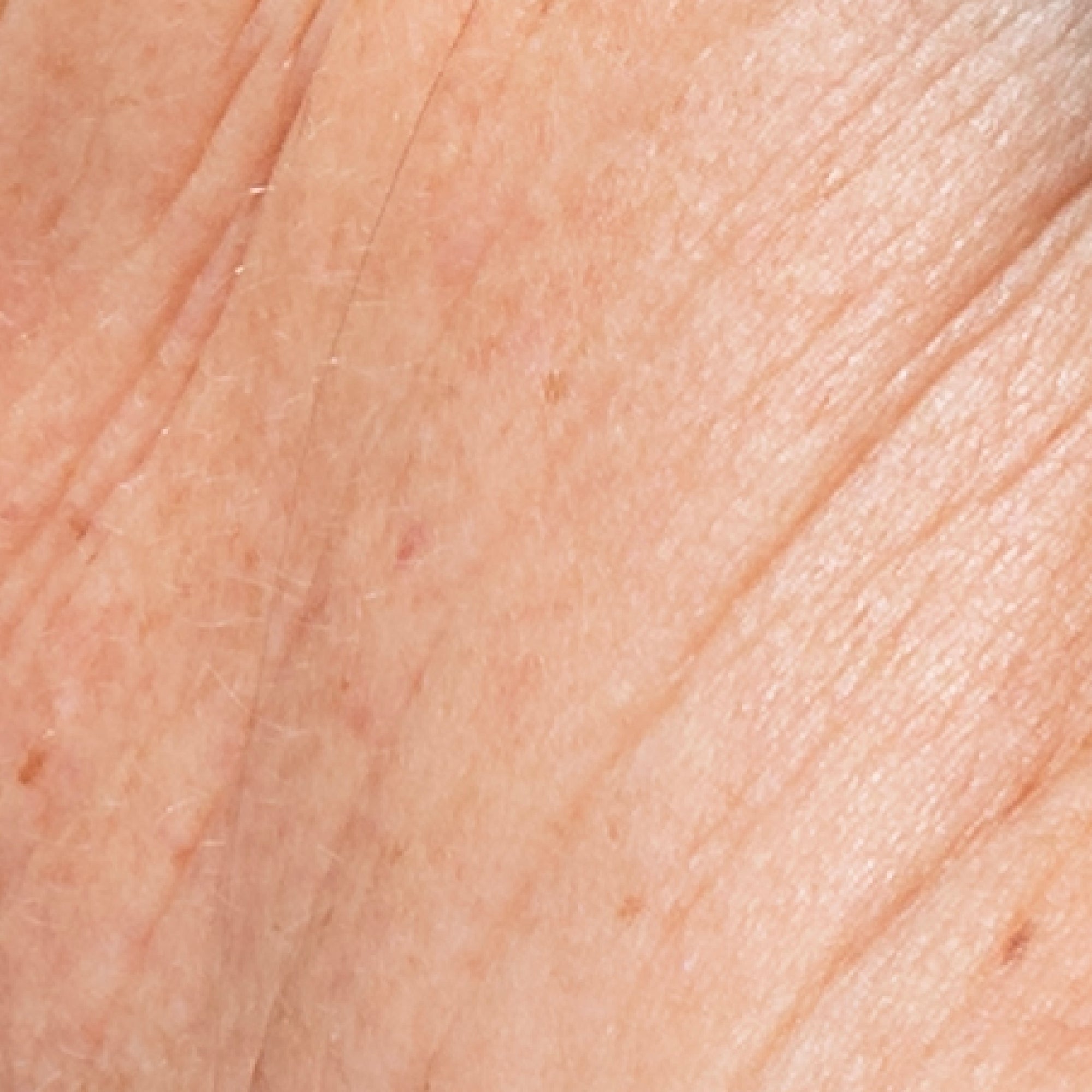 Skin Brightening Collagen in Malaysia | Hydrolyzed Peptides