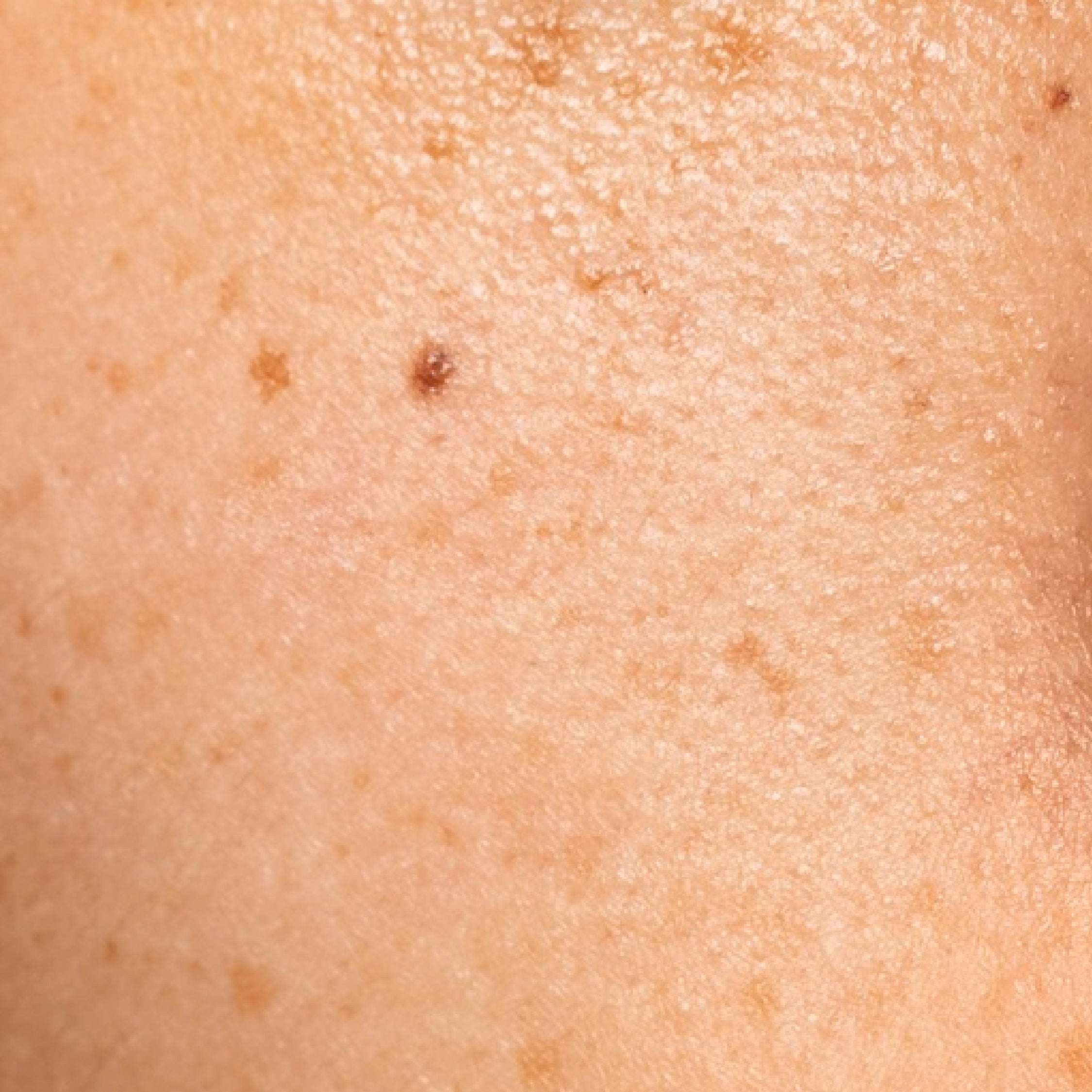 Skin Brightening Collagen in Malaysia | Hydrolyzed Peptides